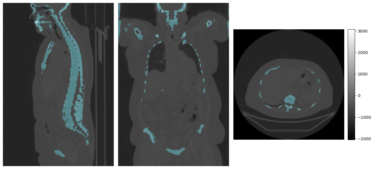 Running Model Inference with the ImFusion Python SDK — imfusion-sdk 0.10.0+webshop.pro documentation