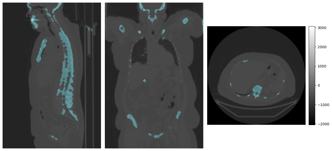 Running Model Inference with the ImFusion Python SDK — imfusion-sdk 0. ...